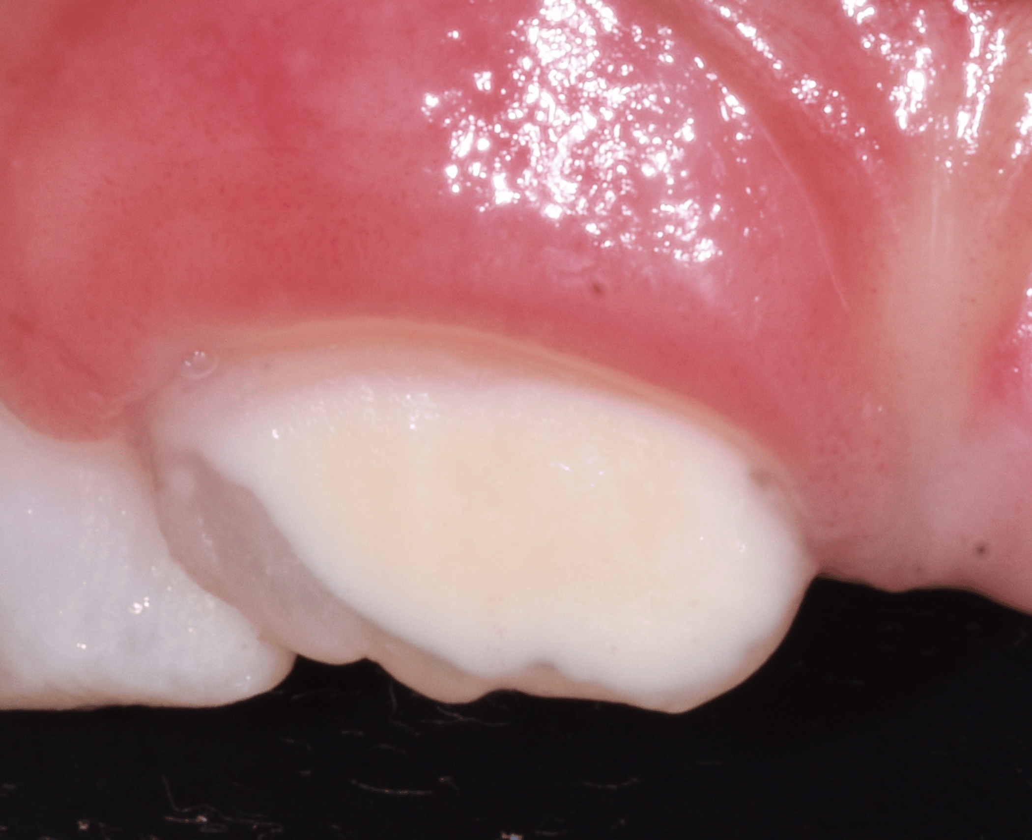 M.I.H | Formation E-learning DPC | Chirurgiens-dentistes